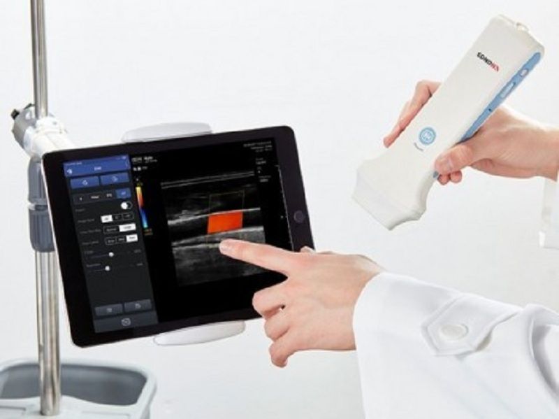 MM-210,Mini Sono-Alpinion Medical Ultrazvucni portabolni aparat cena ...